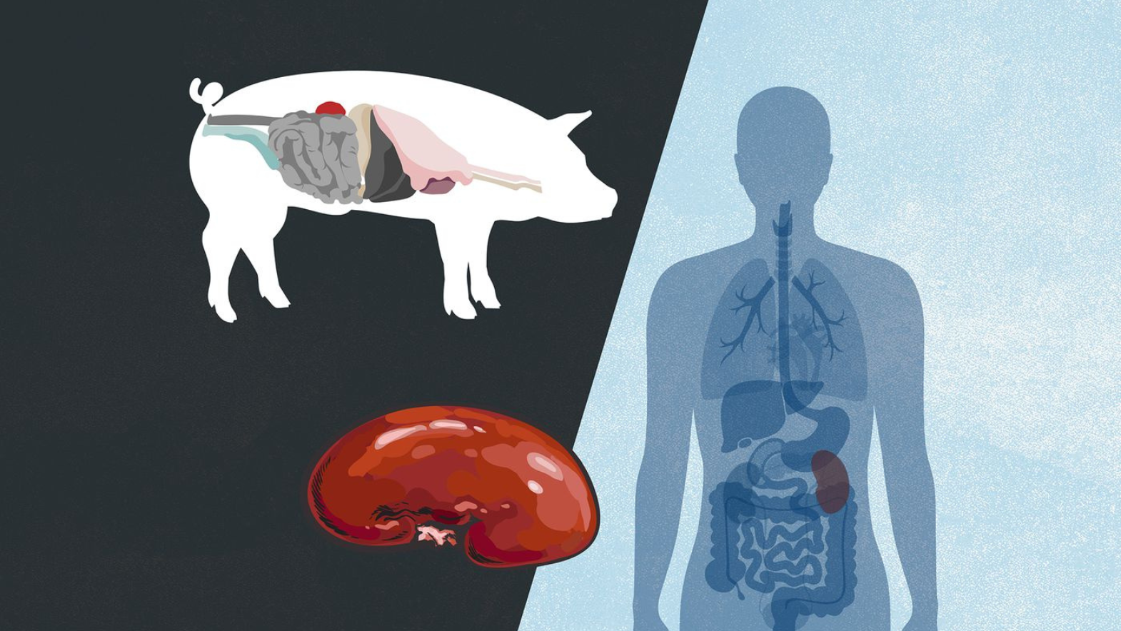 Scientists created humanized kidneys in pigs | Inquirer Technology