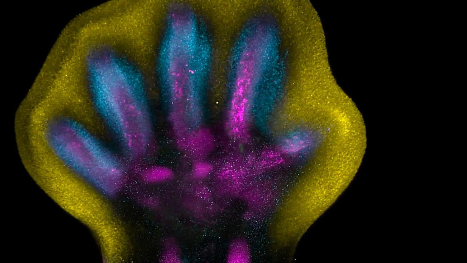 Study explains how human fingers, toes grow | Inquirer Technology